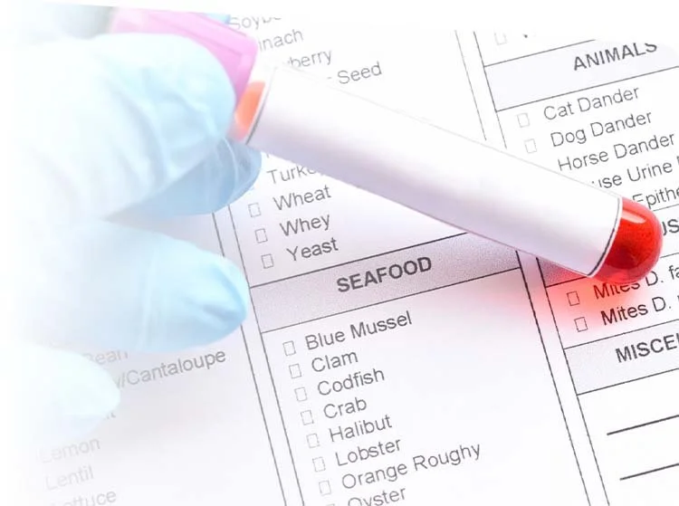 Allergy Testing in Cork - MedHub