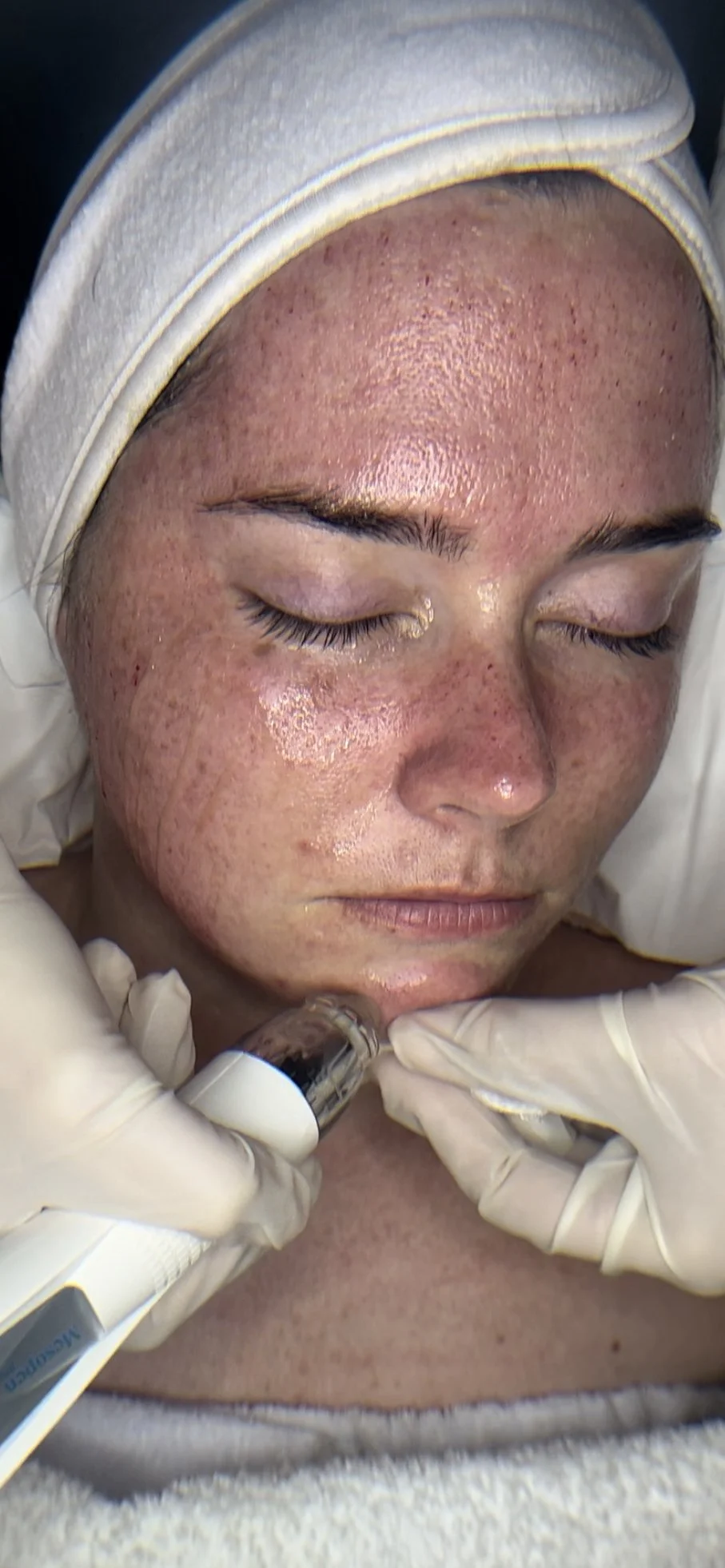 Skin Treatments — CuraSkin