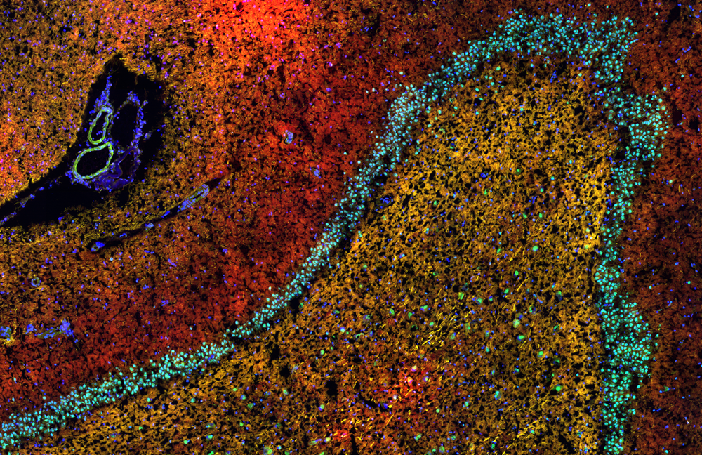 Research — FAN LAB