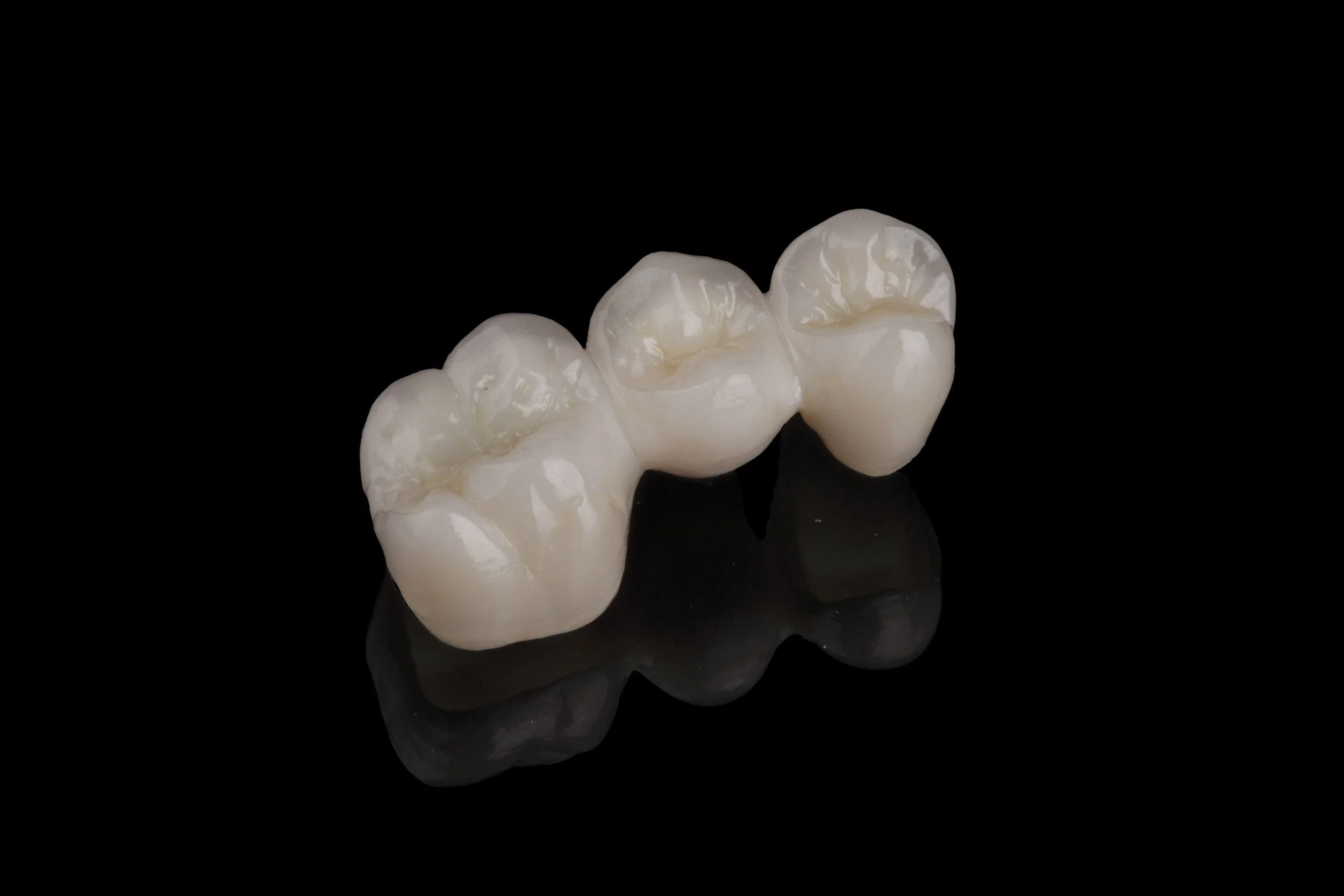 Crown and Bridge — Aceso Dental USA