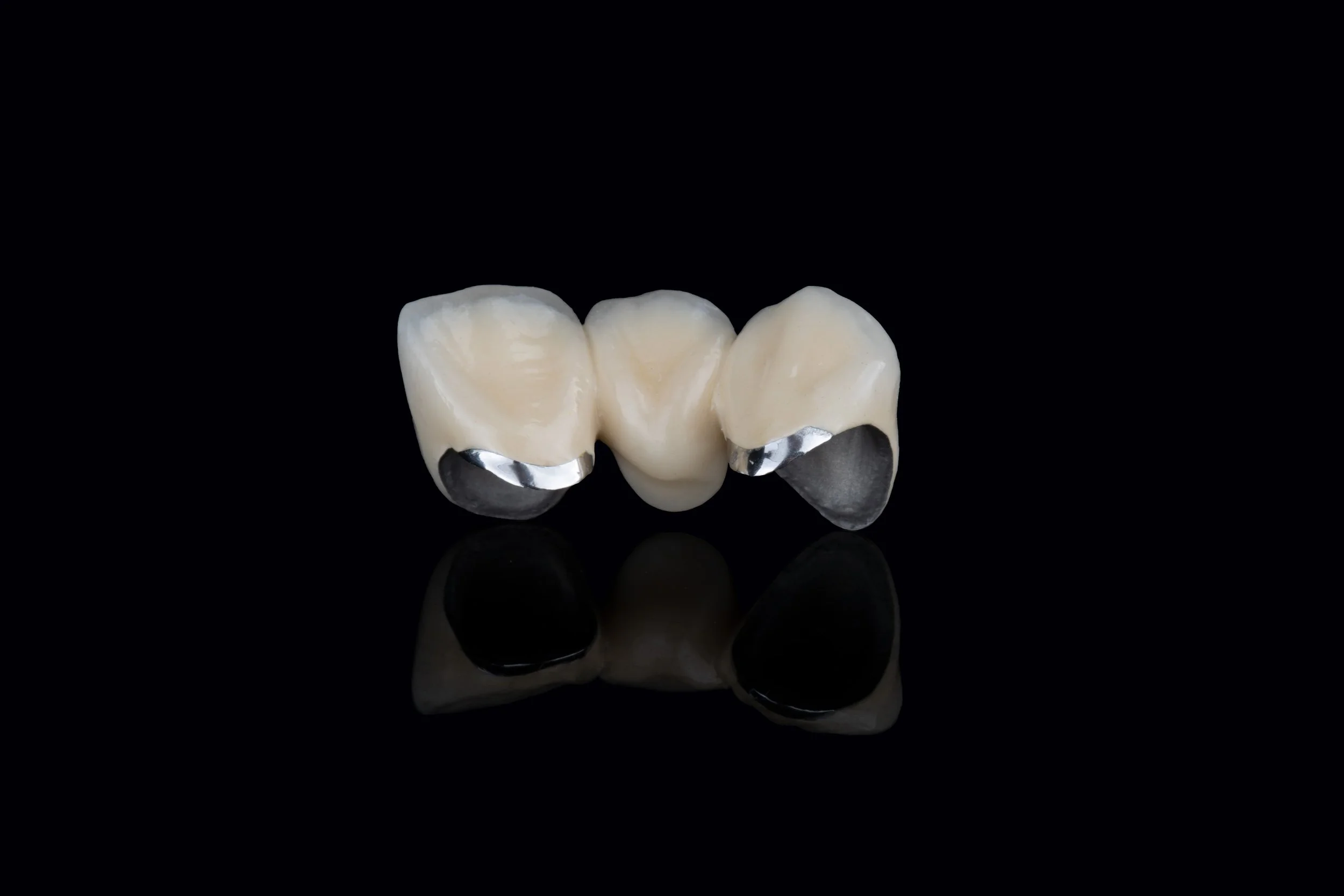 Crown and Bridge — Aceso Dental USA