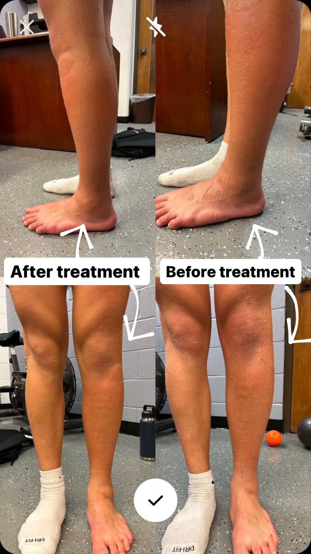 Swelling Reduction Protocol Download — MovementREV — Anna Hartman