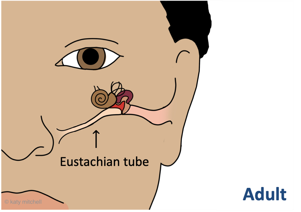 What causes glue ear? — Glue Ear Together