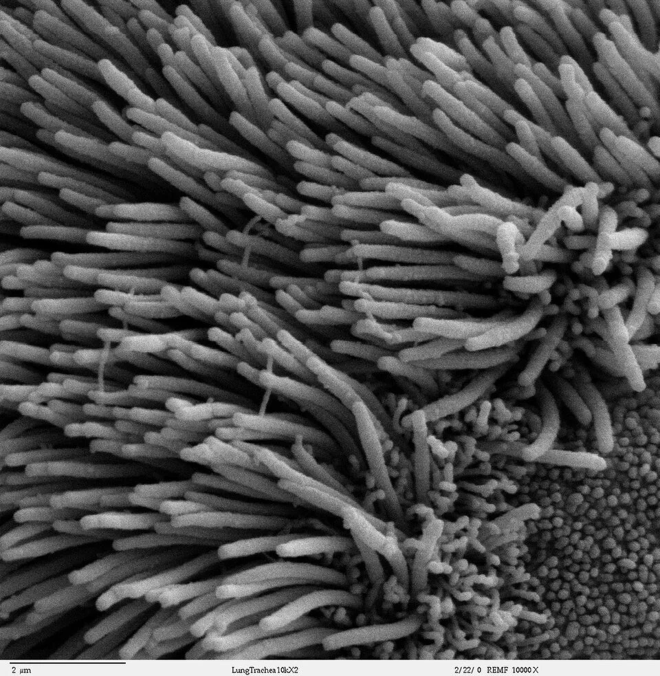 What happens in your body when you sneeze? — Today You Should Know
