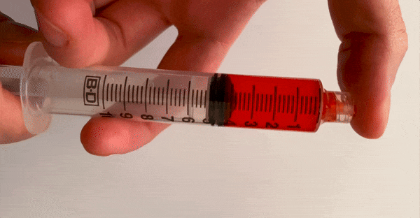 Why do joints crack? — Today You Should Know