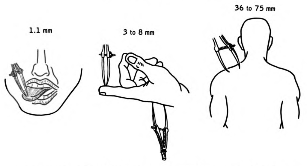 Why do paper cuts hurt so much? — Today You Should Know