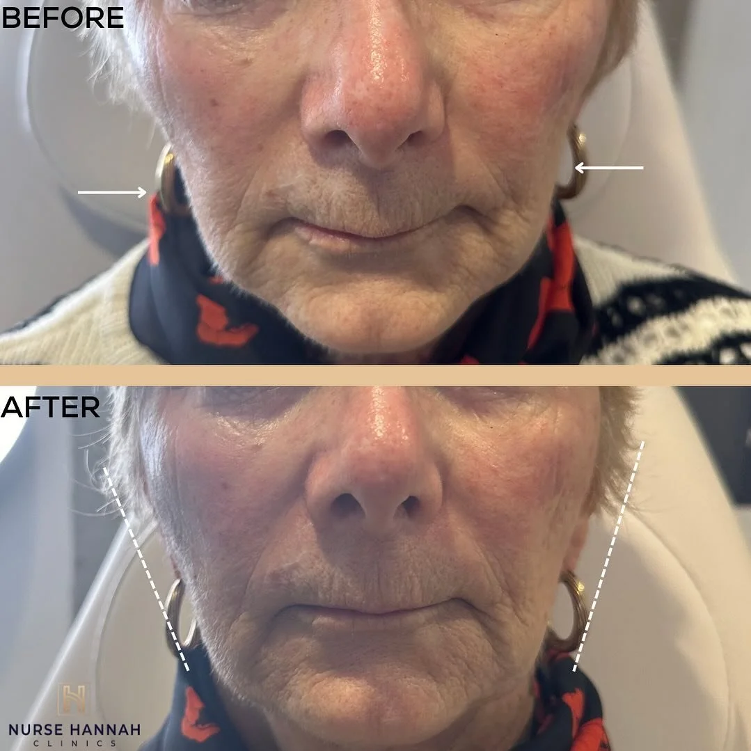 Free Skin Tool — Nurse Hannah Clinics