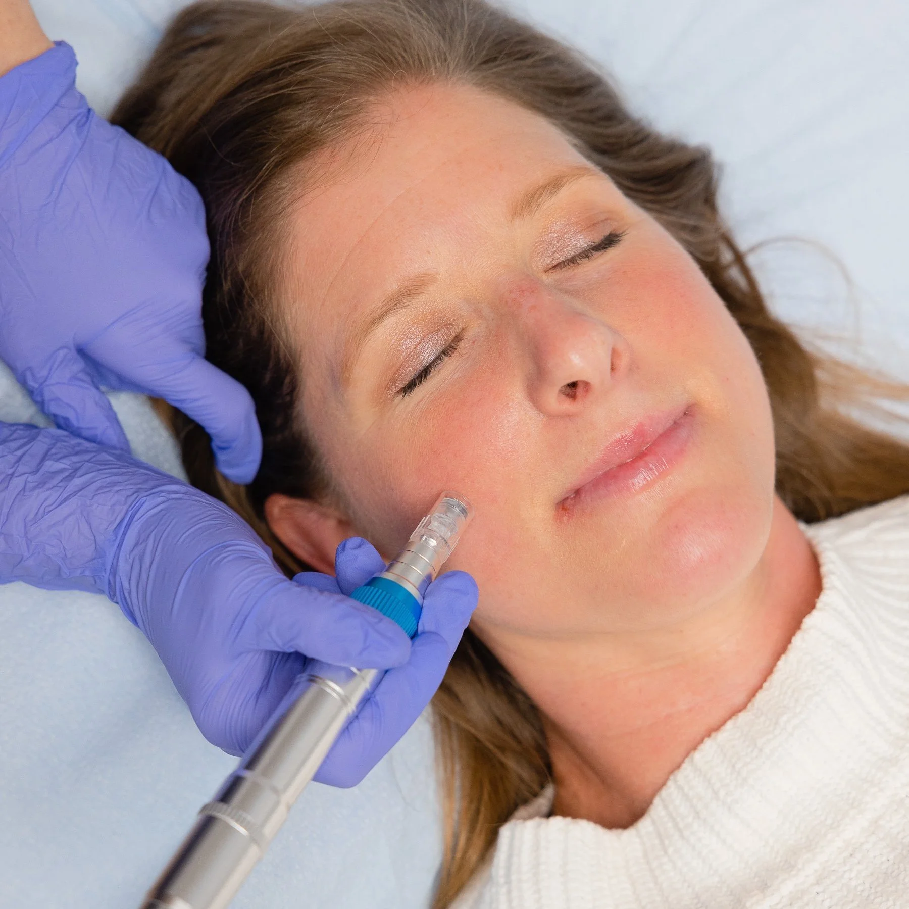 Holistic Skincare- Gua Sha Facials, Microneedling, Facial Acupuncture