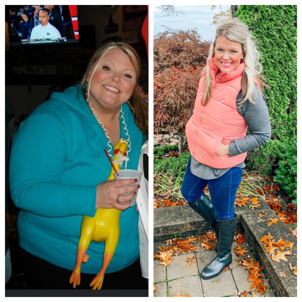 Mindful and Intuitive Eating After Bariatric Surgery - A Realistic ...