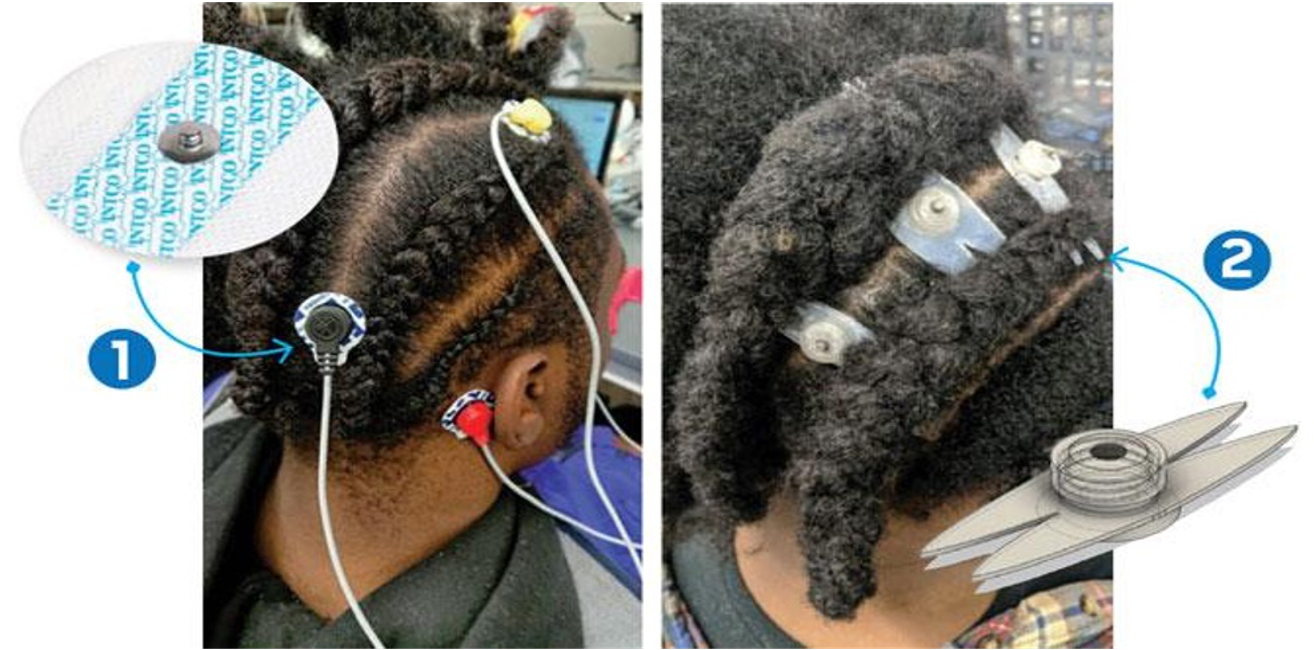 Sevo — Precision Neuroscopics