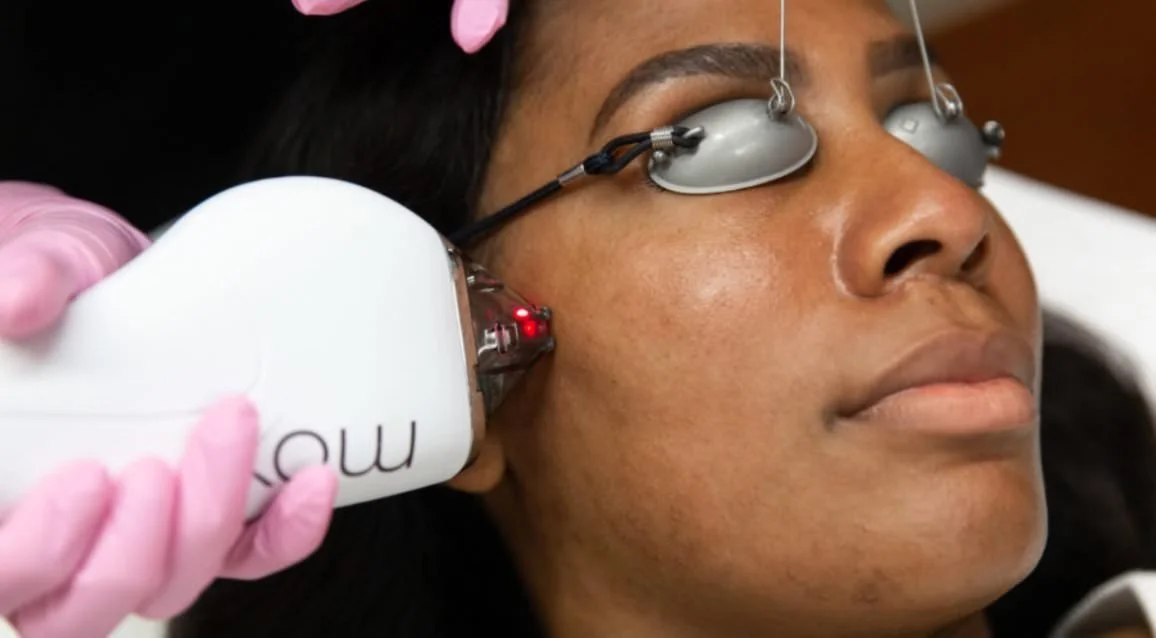 Moxi Laser by Sciton in Portland Maine | Aesthetic Laser Treatments ...