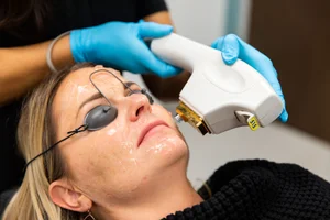 Aesthetic Laser Treatments — Rejuvenations Medi Spa