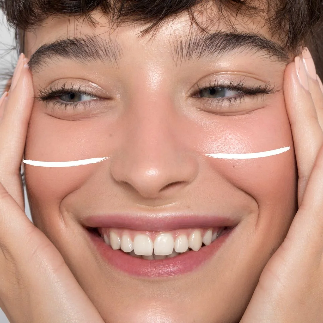 Dermal Filler and PDO Treatments by Intraline — Intraline.com