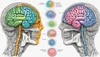 Sociopath Brain vs Normal Brain: Understanding Neural Differences