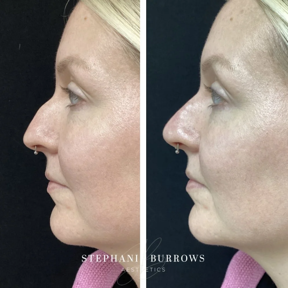 Stephanie Burrows Aesthetics