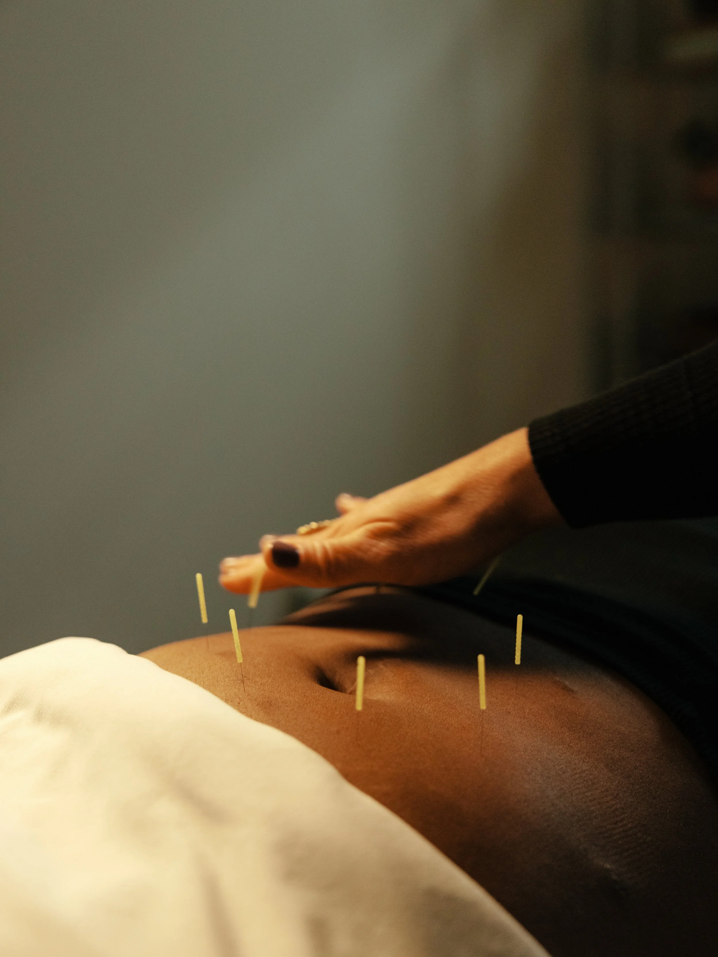 what is acupuncture? — tatum fjerstad, trauma-informed acupuncture in ...