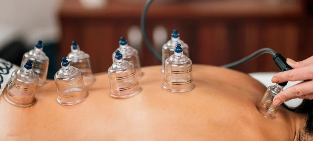 Cupping Therapy Benefits: How It Promotes Deep Muscle Recovery in ...