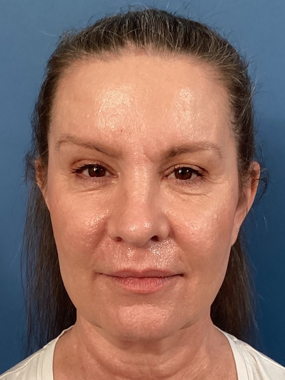 Laser Treatments — Pearl Plastic Surgery and Medical Spa - Olympia ...
