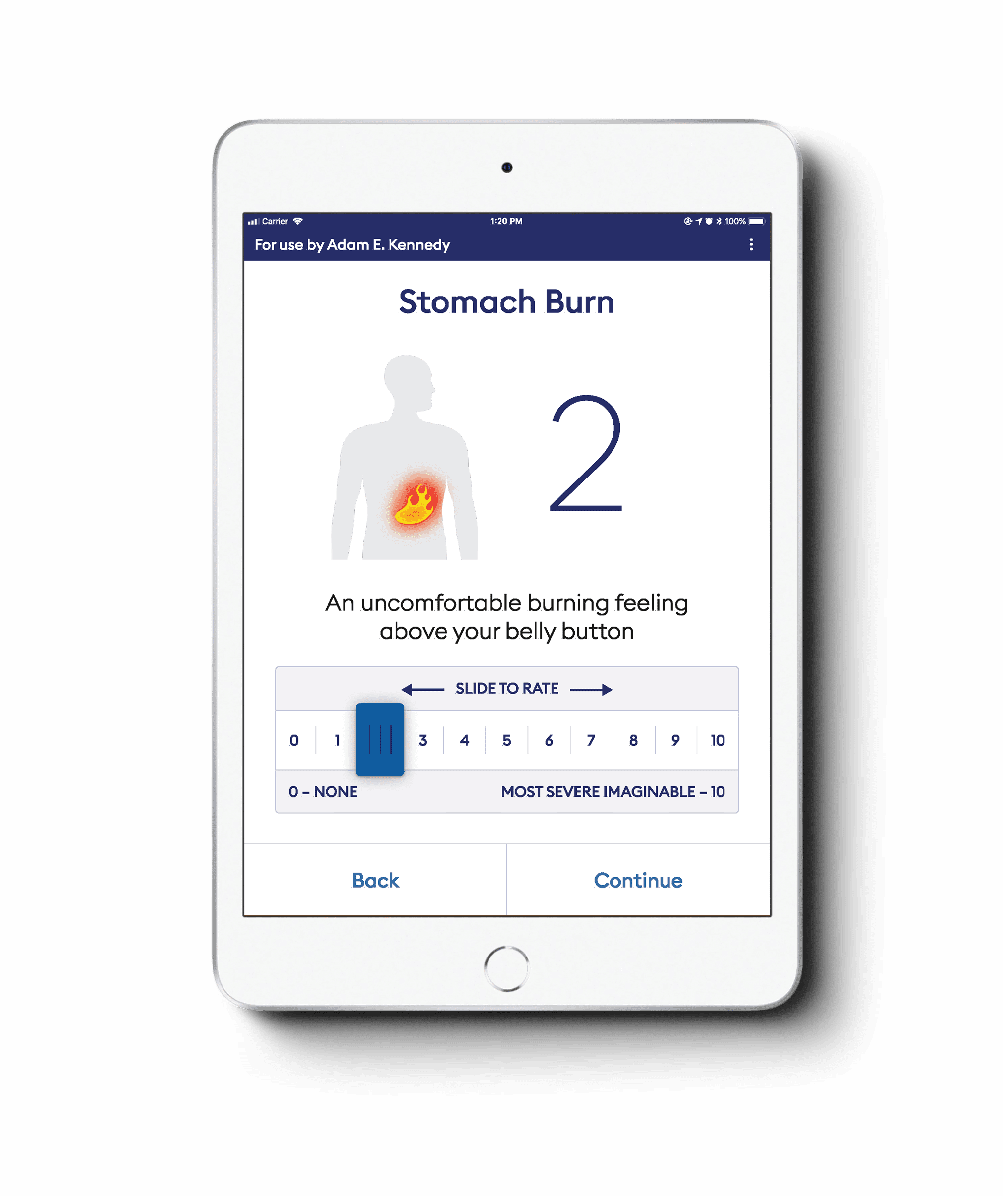 Alimetry in Practice — Alimetry