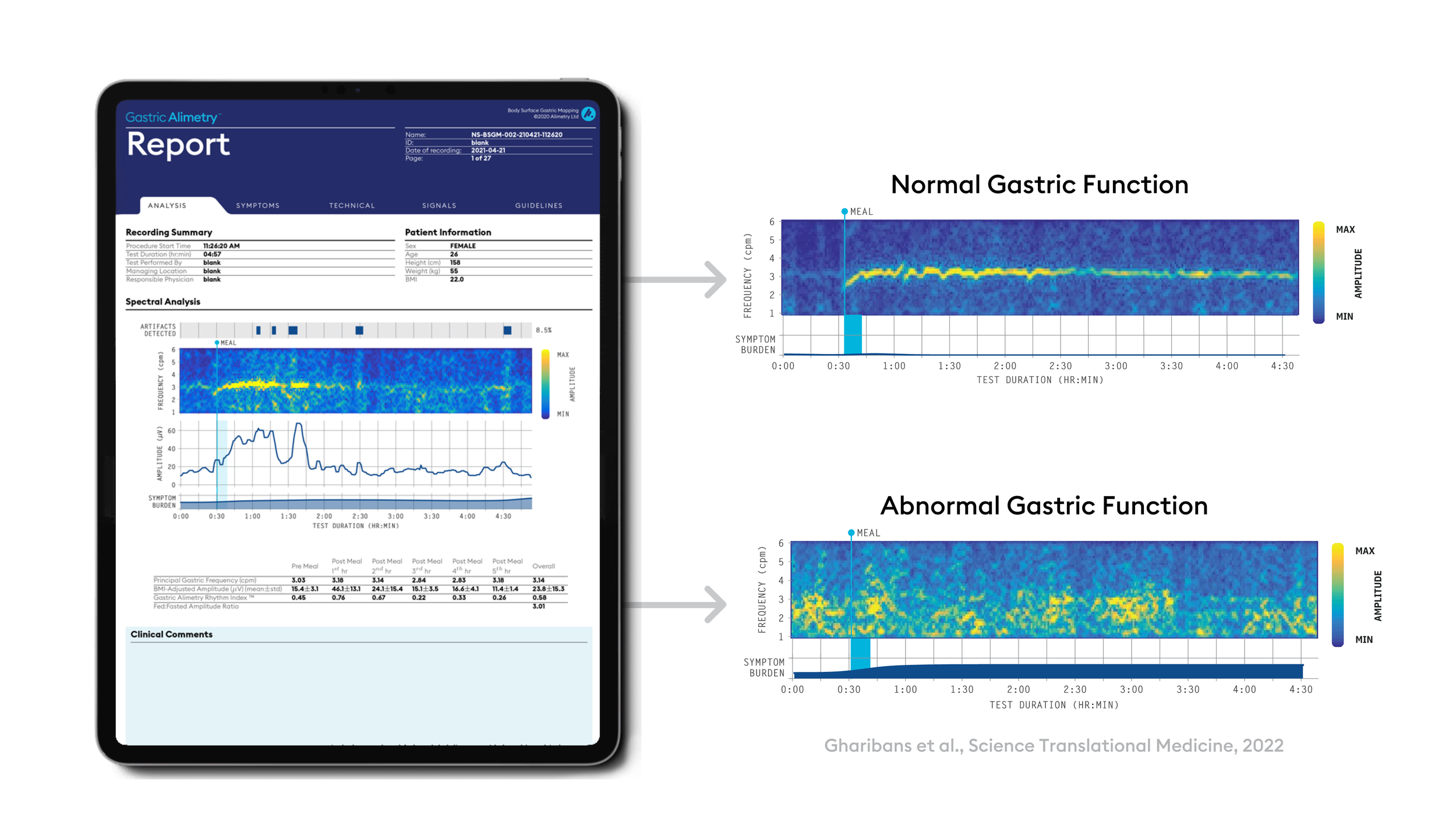 Gastric Alimetry in Practice | Alimetry