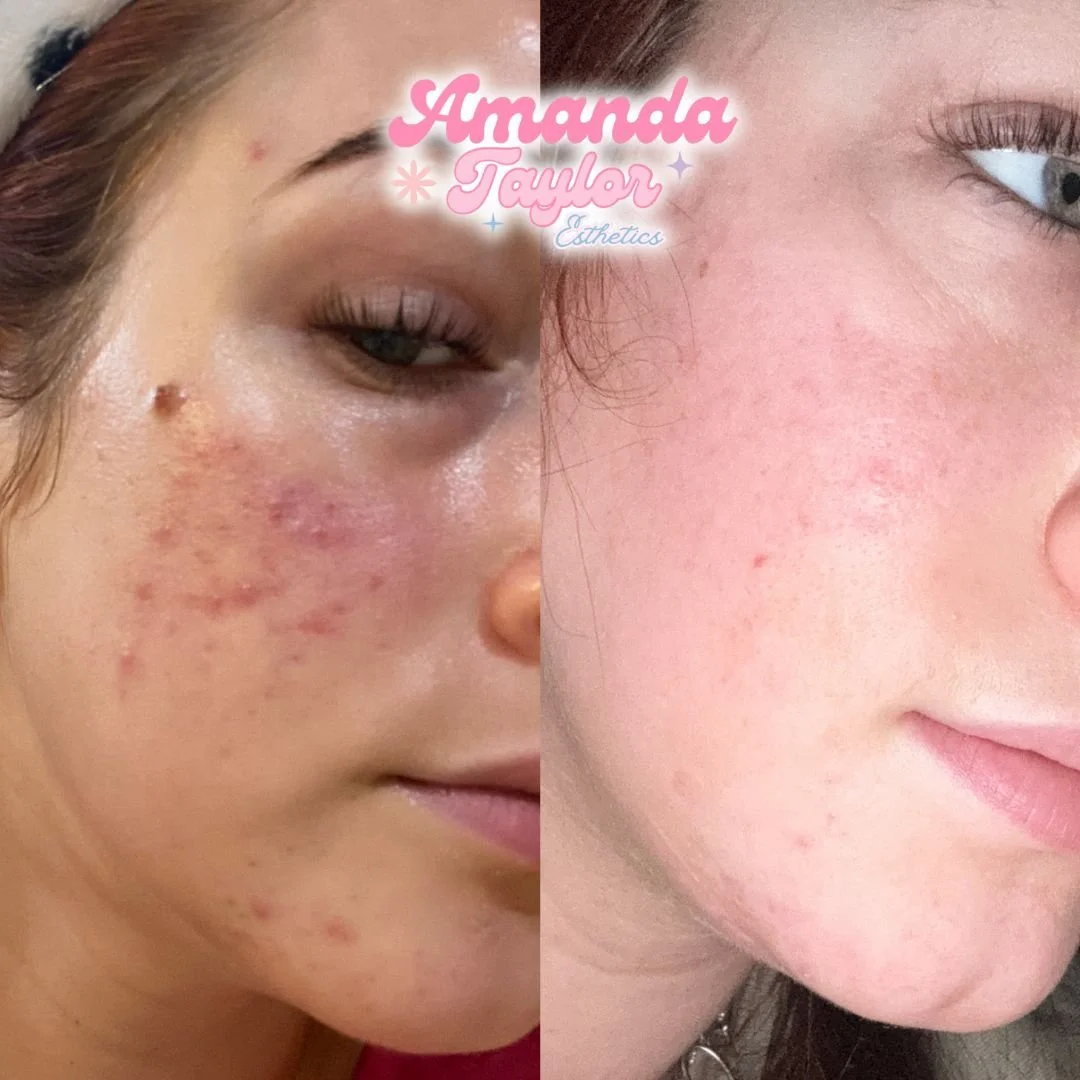 Amanda Taylor Esthetics