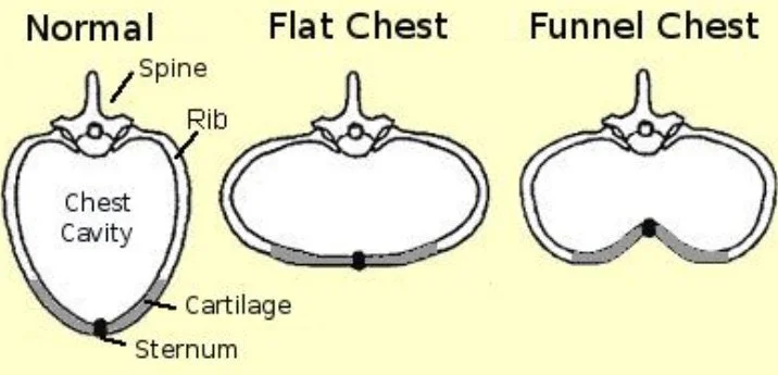 Flat-chested kitten syndrome (FCKS) — Critical Care Kitten Coalition