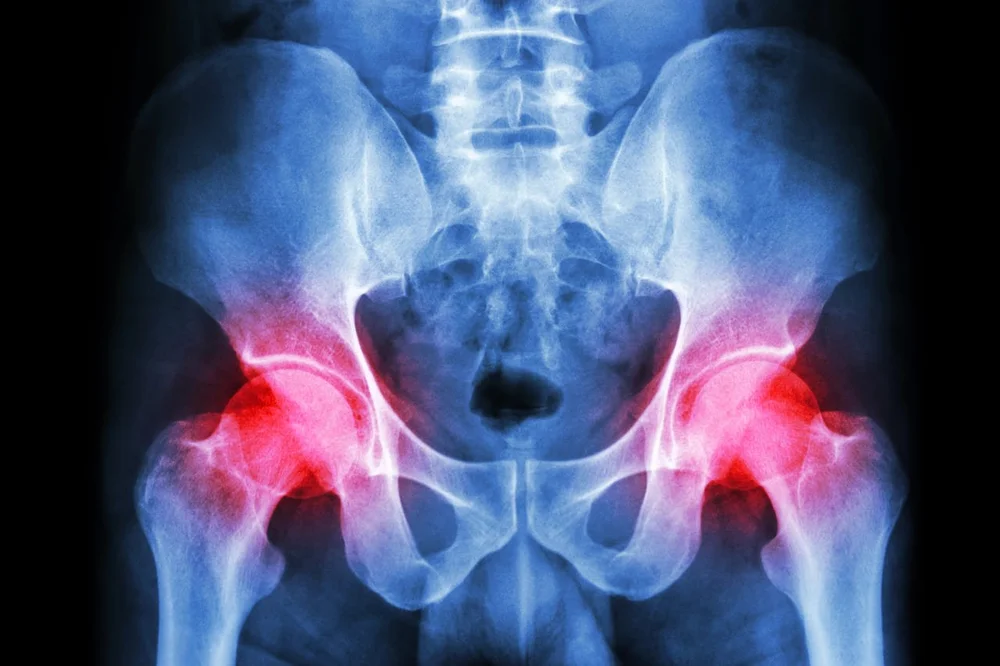 Support for Pelvic Health: How Physiotherapy Helps with Common ...
