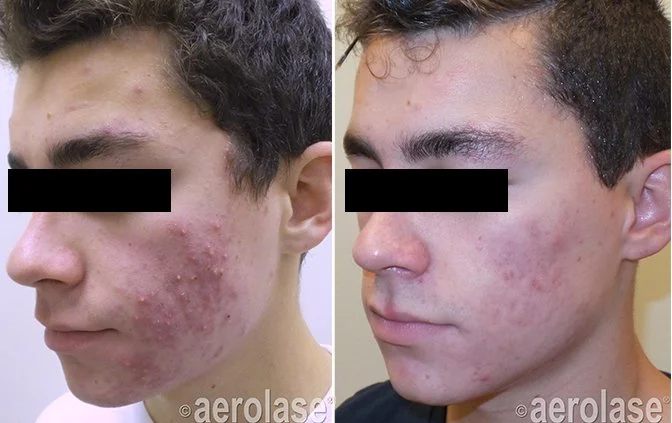 Skin Care — The Face Space