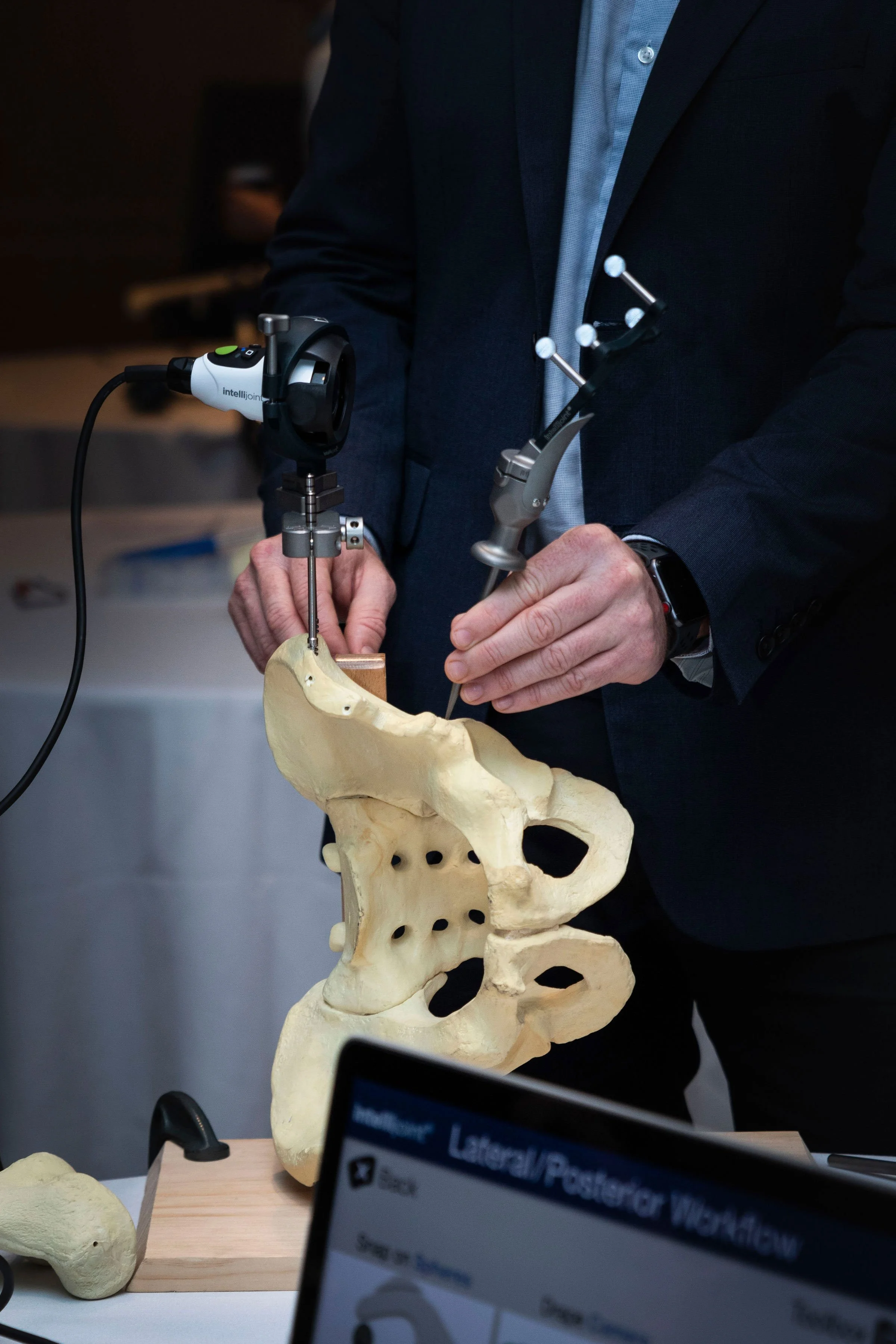 APOS — Australian Paediatric Orthopaedic Society