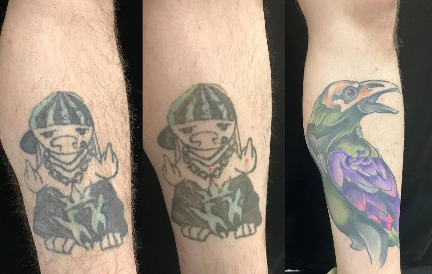 Vanishing Point Laser Tattoo Removal