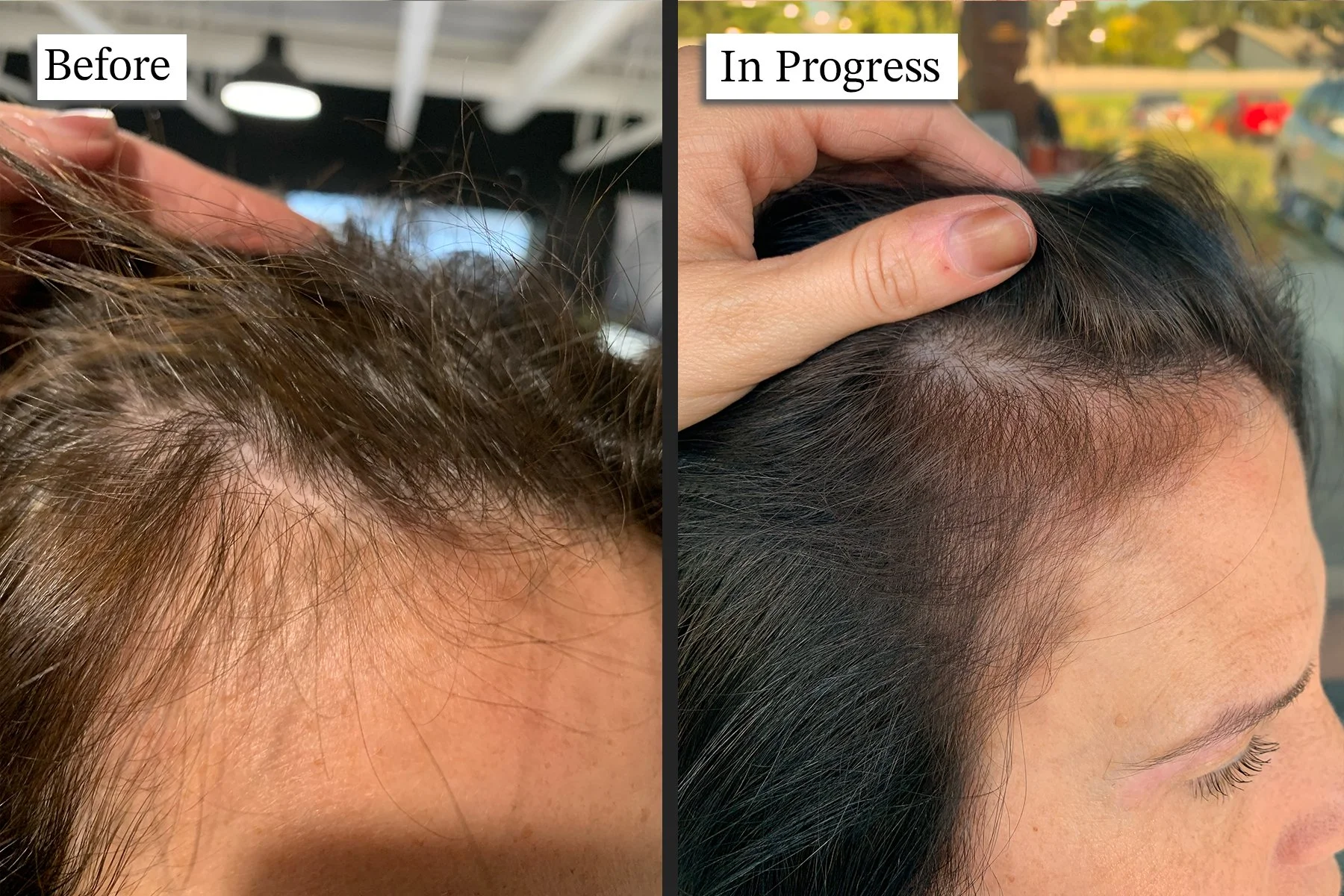 About 1 — Renew Hair Loss Center