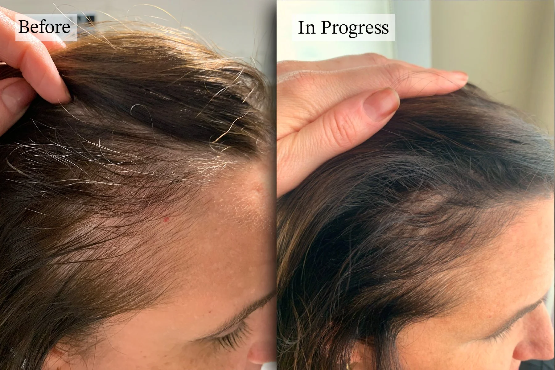 Renew Hair Loss Center