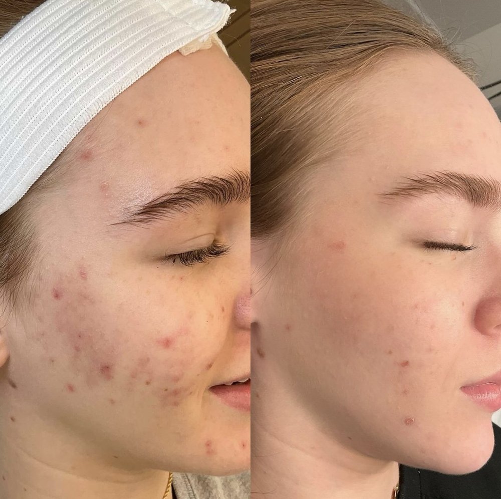 Lumi Skin Bar + Aesthetics