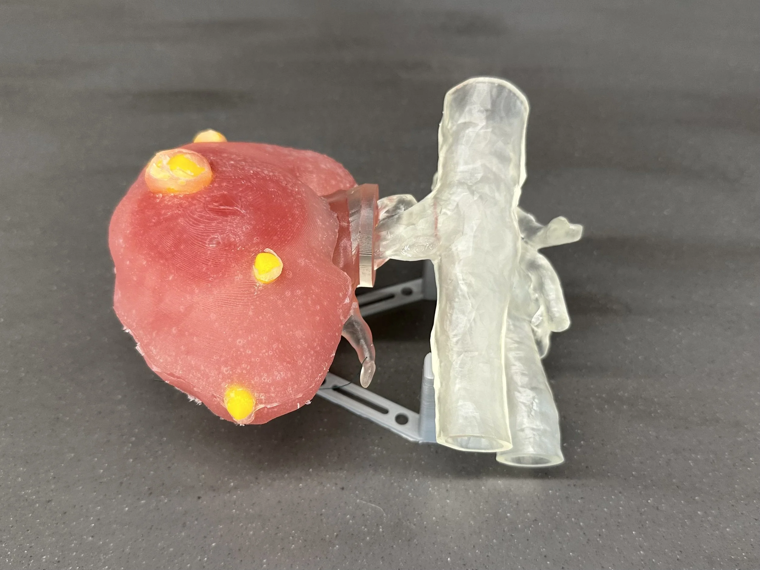 Partial Nephrectomy Training Model — Christina Chan