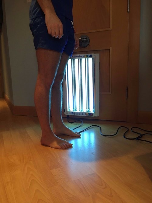UVB Lamps e6000 — UVB Narrowband Lamps for Psoriasis
