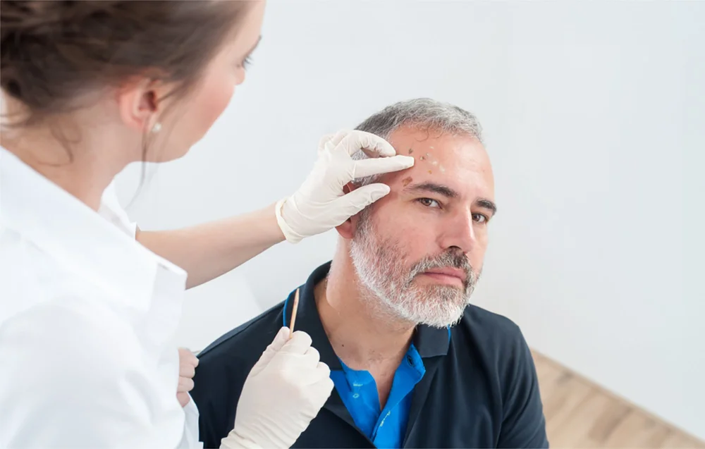 Actinic Keratosis — Fisher Dermatology & Aesthetics