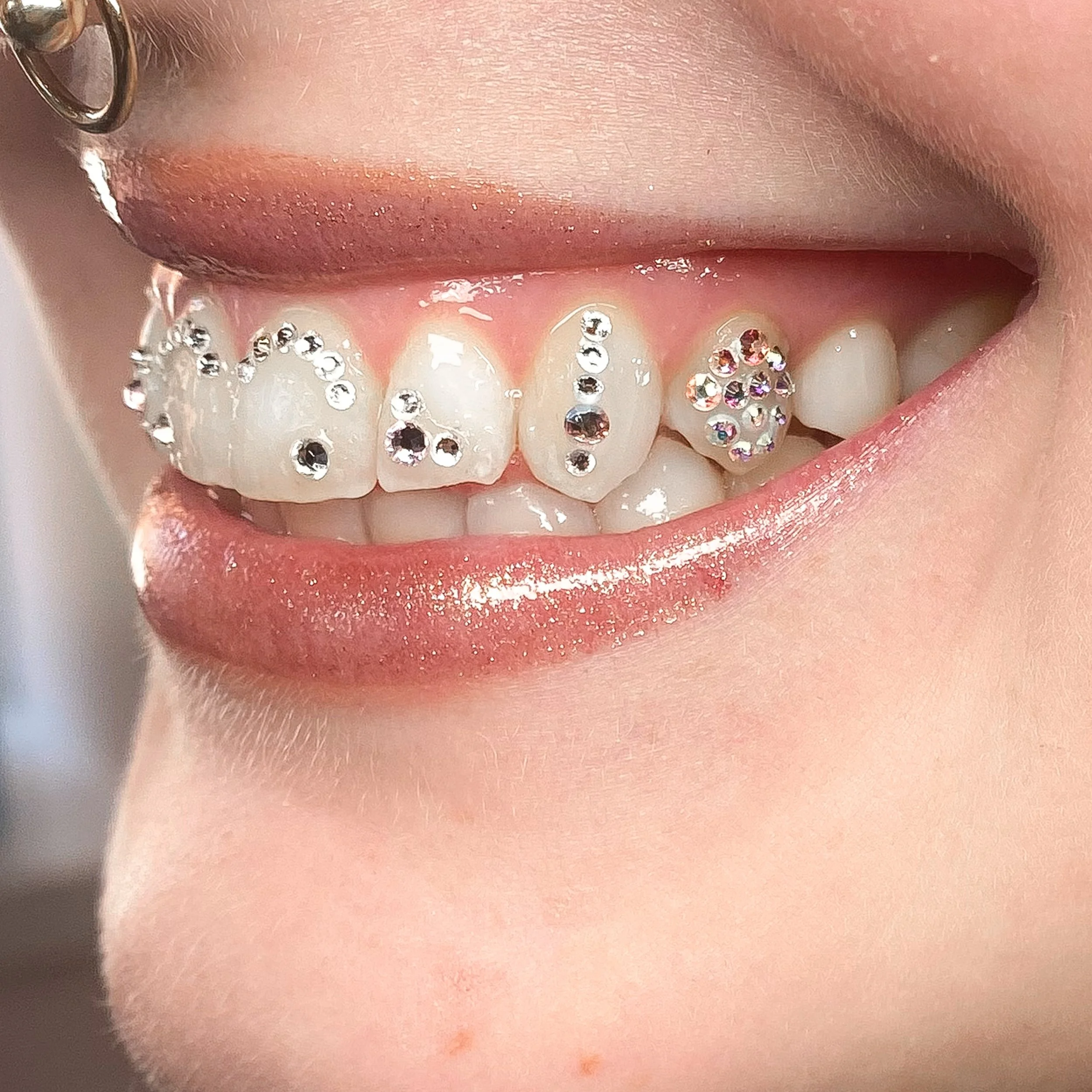 Safe Tooth Gems: Enhancing Your Smile without Compromising Your Oral H ...