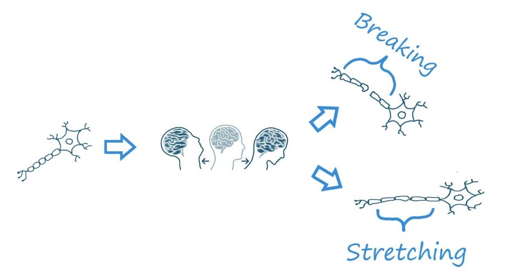 What happens to your brain when you get a concussion? — Concussion Alliance