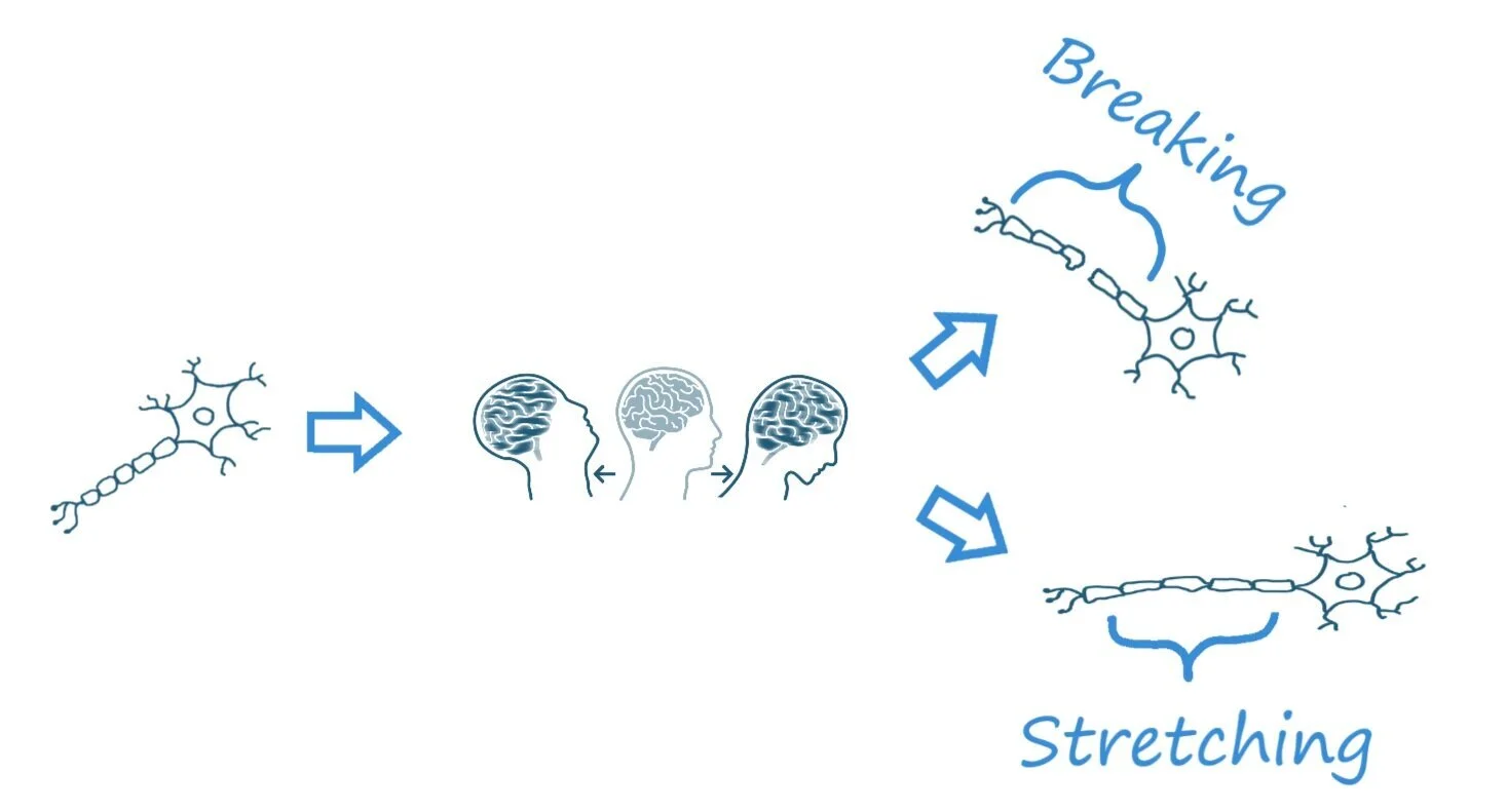 What happens to your brain when you get a concussion? — Concussion Alliance