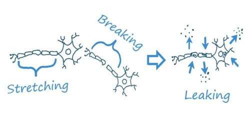 What happens to your brain when you get a concussion: a deeper dive ...