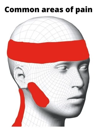 Headaches — Concussion Alliance