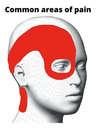 Headaches — Concussion Alliance