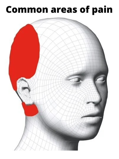 Headaches: Advanced Page — Concussion Alliance