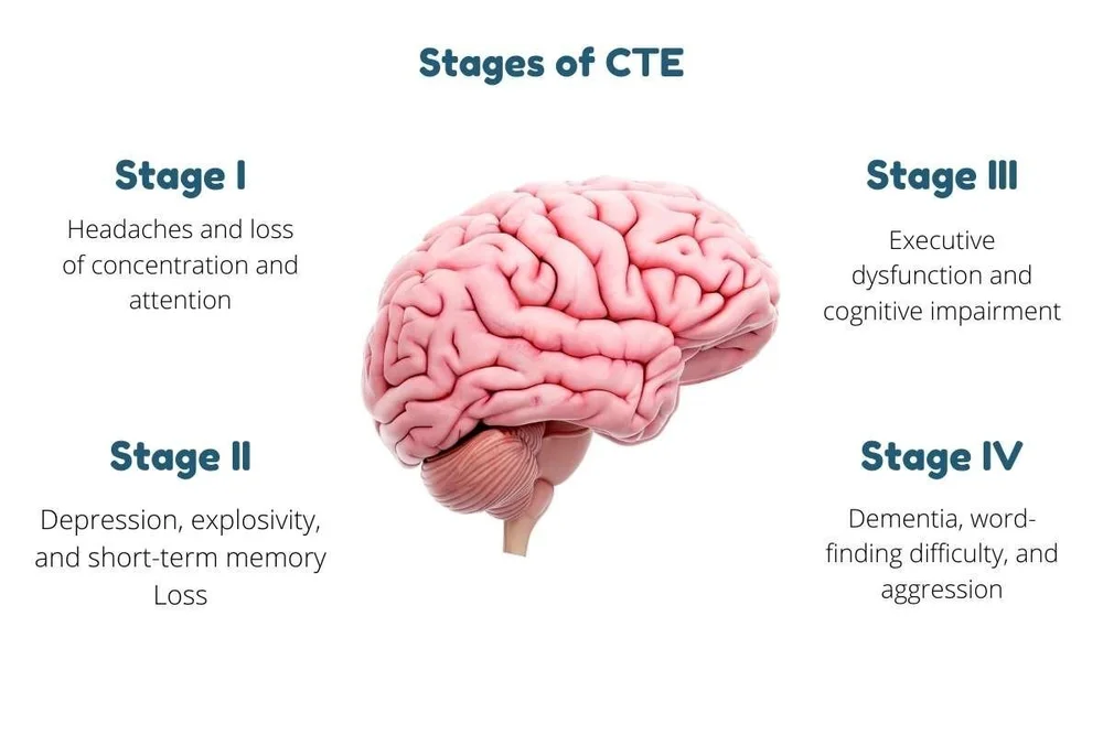 Neurodegenerative Diseases — Concussion Alliance