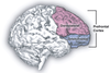 Cognitive Dysfunction After Concussion — Concussion Alliance
