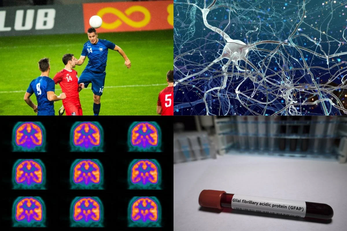 Newsletter — Concussion Alliance