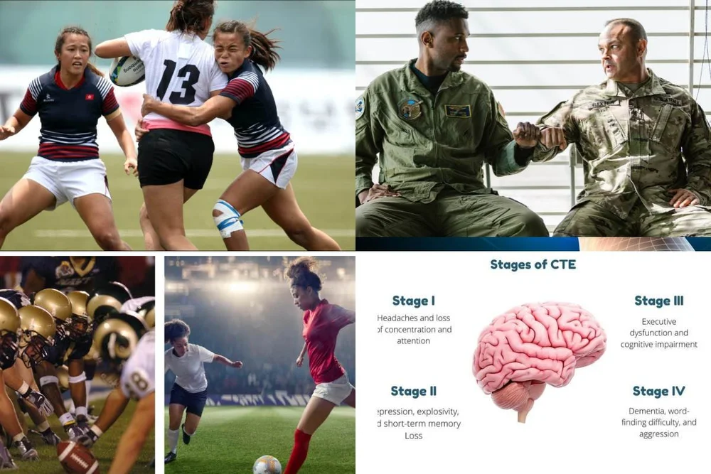 Prior head injury is associated with a 34% increased risk of stroke in ...
