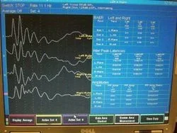 BAER Testing — vetneurochesapeake