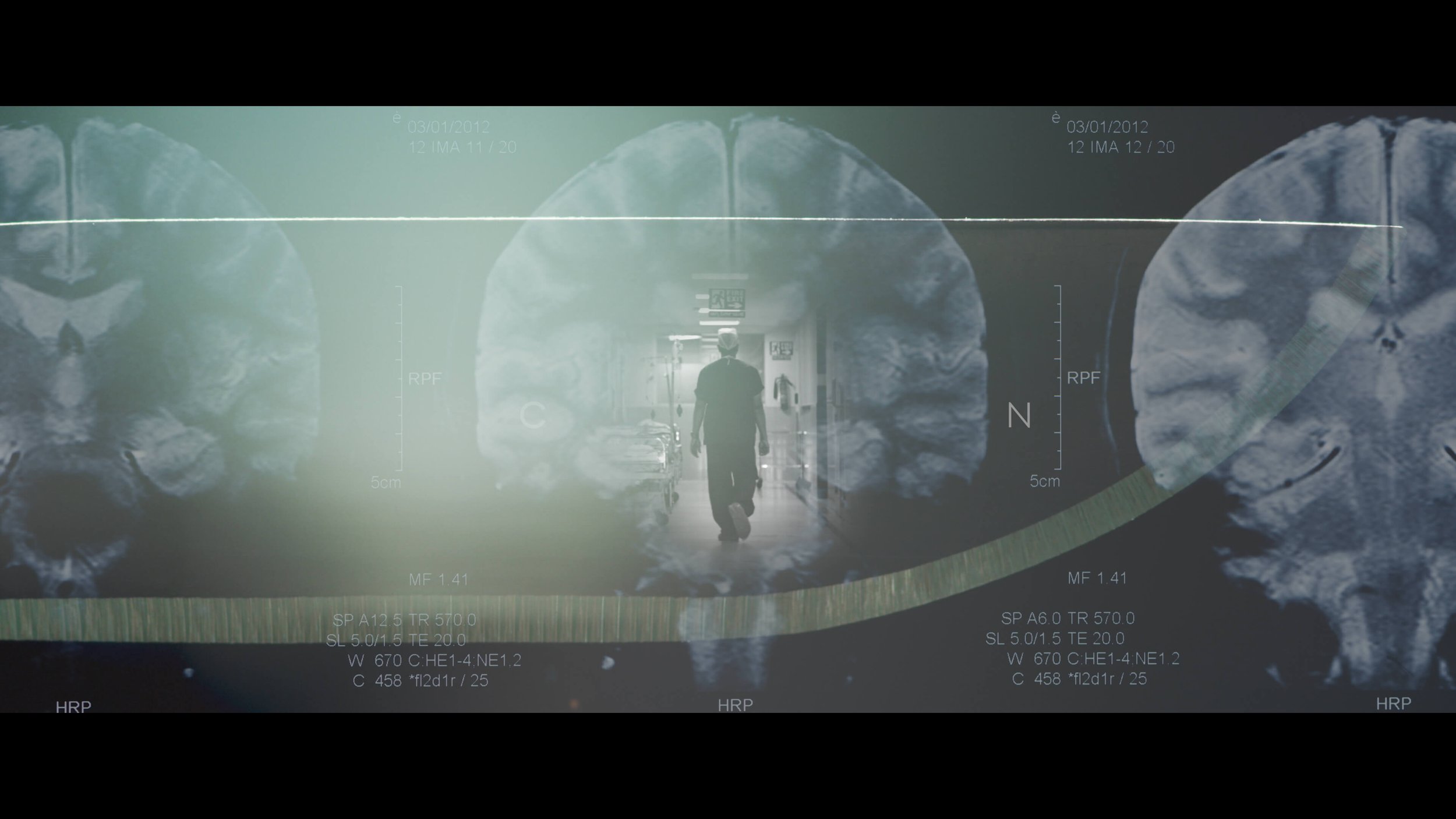 The Surgeon's Cut — Lux Aeterna VFX