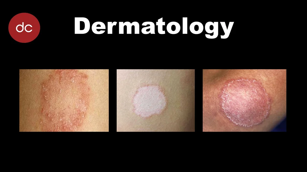 Davinci Cases Davinci Academy